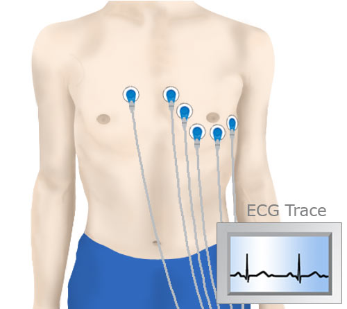 Abnormal ECG | Dr Khairy